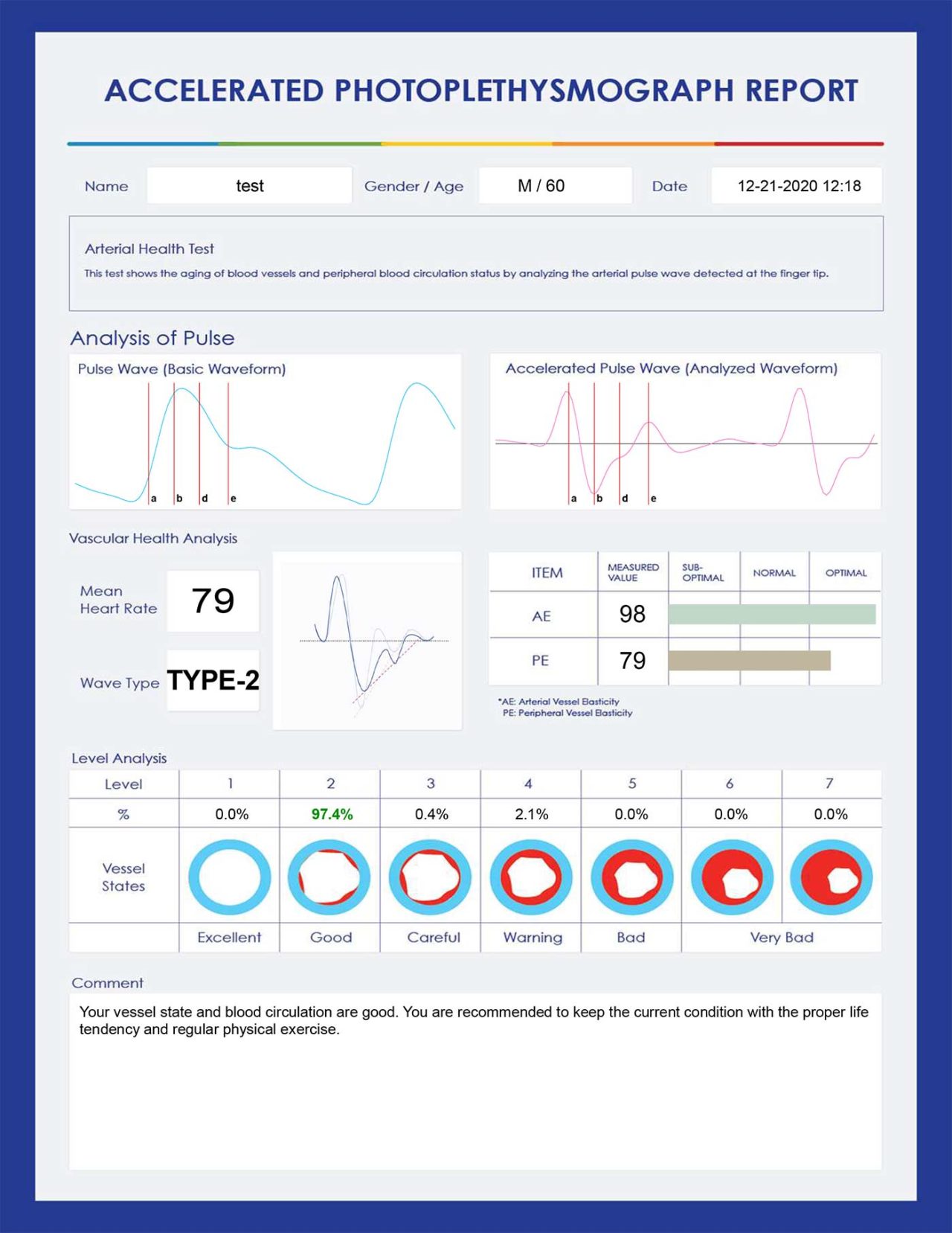 The Cardio Wave Analyzer Report - The CardioWA - Cardio Wave Analyzer